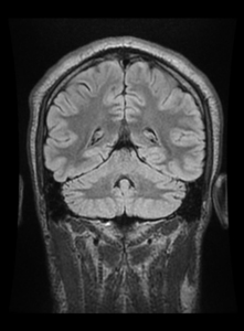 IRM | Centre de radiologie Sud Rhône Imagerie