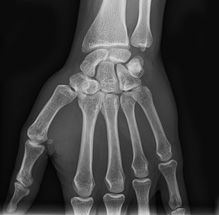 Radiologie générale | Centre de radiologie Sud Rhône Imagerie