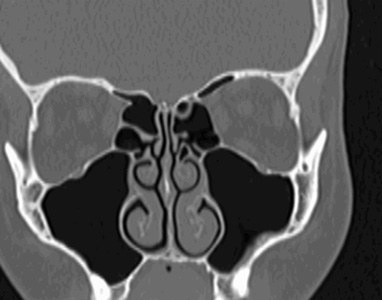 Scanner | Centre de radiologie Sud Rhône Imagerie